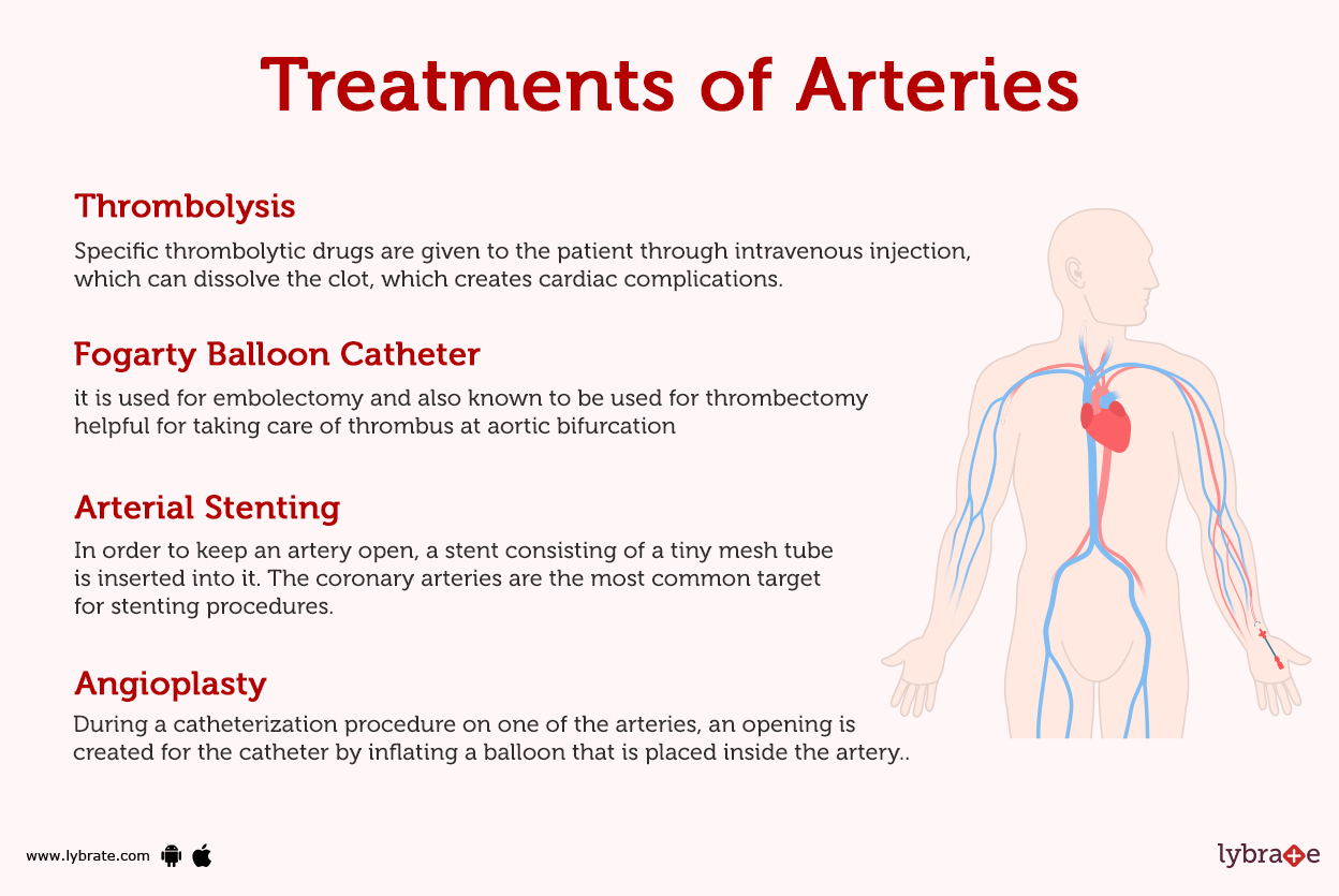 Arteries (Human Anatomy): Picture, Definition, Diseases, & More