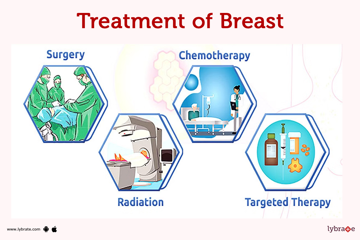 Breasts (Female Anatomy): Image, Function, Diseases, Treatments