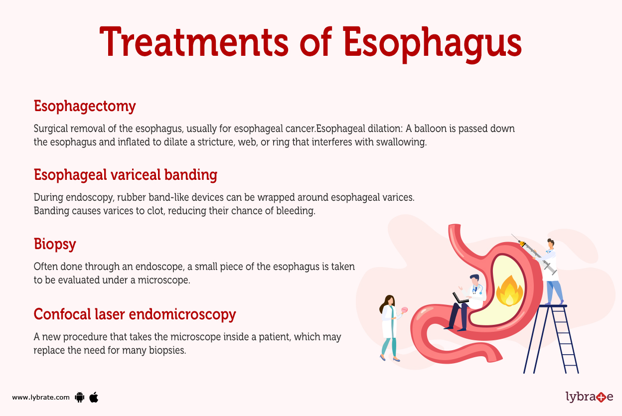 Esophagus (Human Anatomy): Picture, Function, Diseases, Tests, and ...