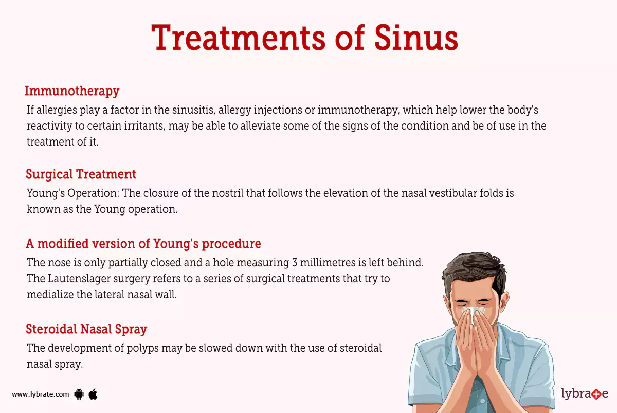 Sinus (Human Anatomy): Picture, Functions, Diseases, and Treatments