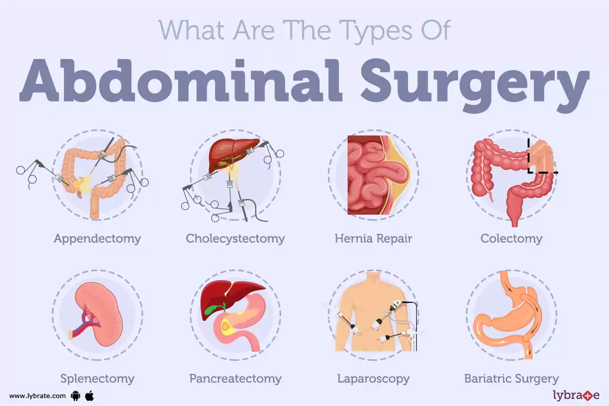 Abdominal Surgery: Causes, Symptoms, Treatment and Cost