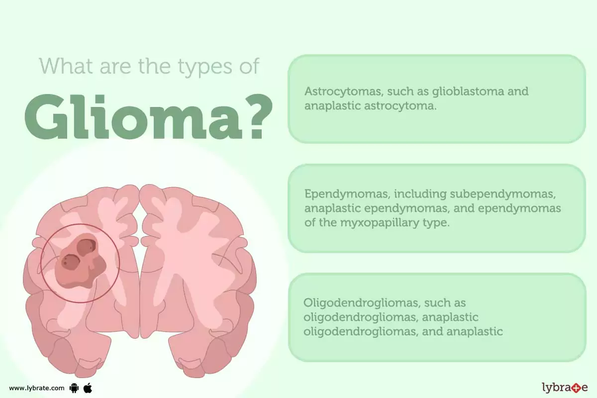 Glioma: Treatment, Procedure, Cost, Recovery, Side Effects And More