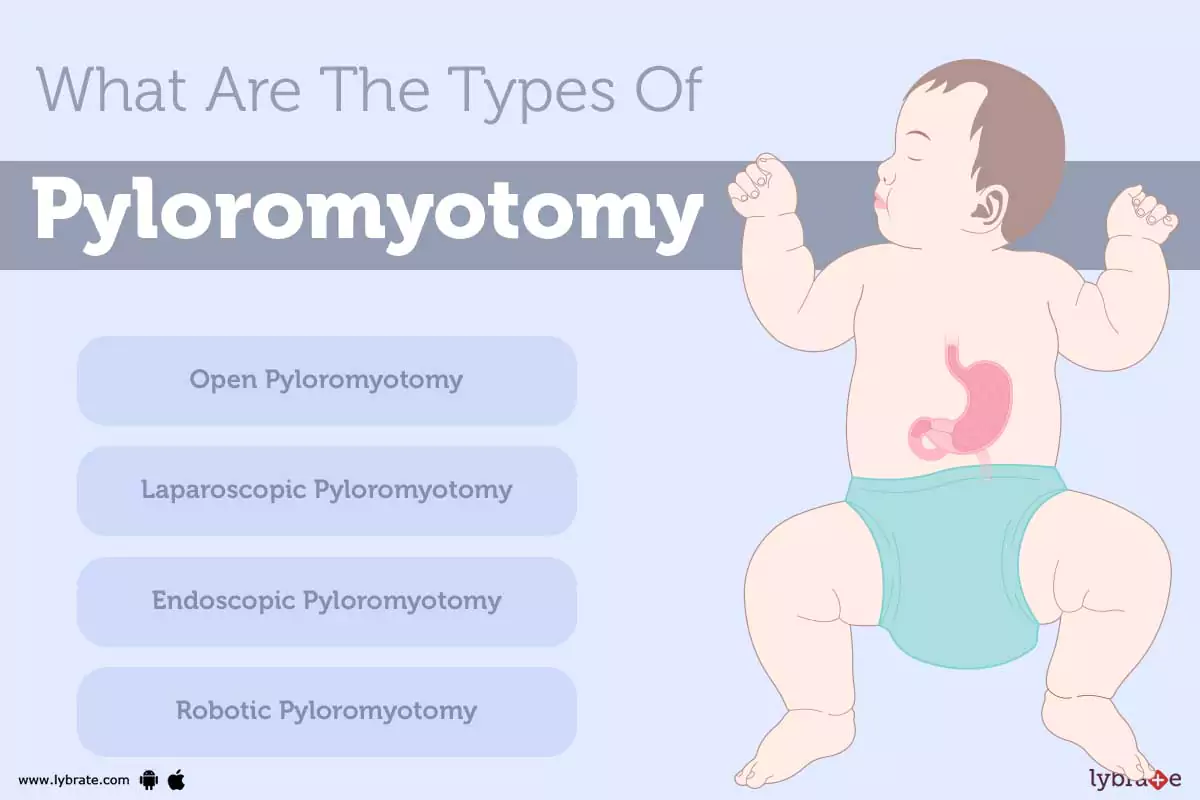 Pyloromyotomy: Causes, Symptoms, Treatment and Cost