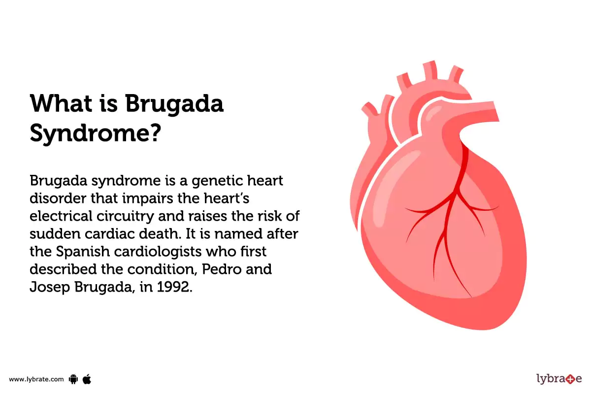 Brugada Syndrome: Treatment, Procedure, Cost, Recovery, Side Effects ...