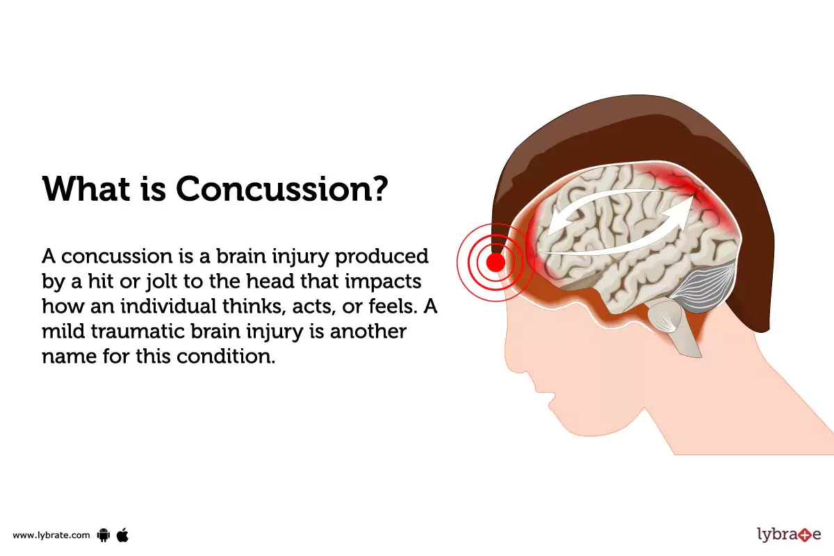 Concussion Causes Symptoms Treatment And Cost Concussion Causes Symptoms Treatment And Cost