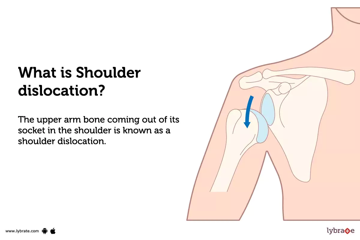 Shoulder Dislocation Causes Symptoms Treatment And Cost
