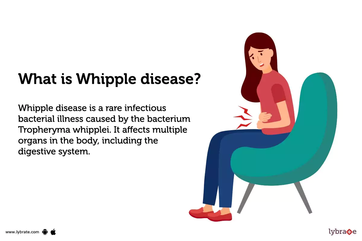 Whipple disease: Causes, Symptoms, Treatment and Cost