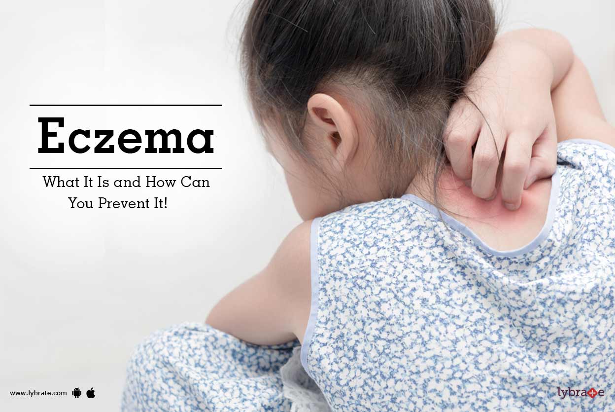 Eczema: What It Is and How Can You Prevent It! - By Dr. Arshi Rahul ...