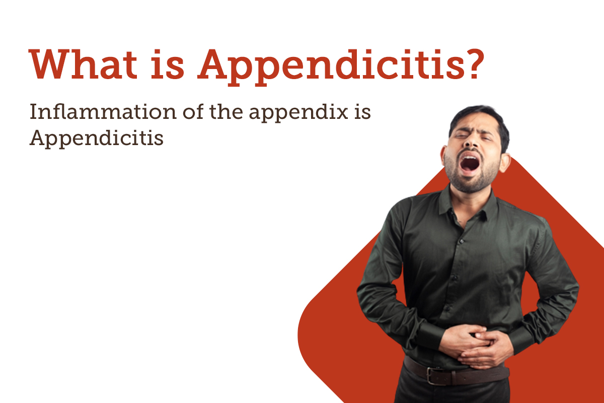 Appendicitis: Know Early Symptoms, Causes, Treatment and Diagnosis