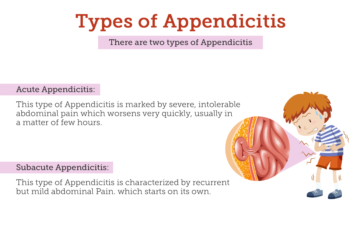 Appendicitis: Know Early Symptoms, Causes, Treatment and Diagnosis