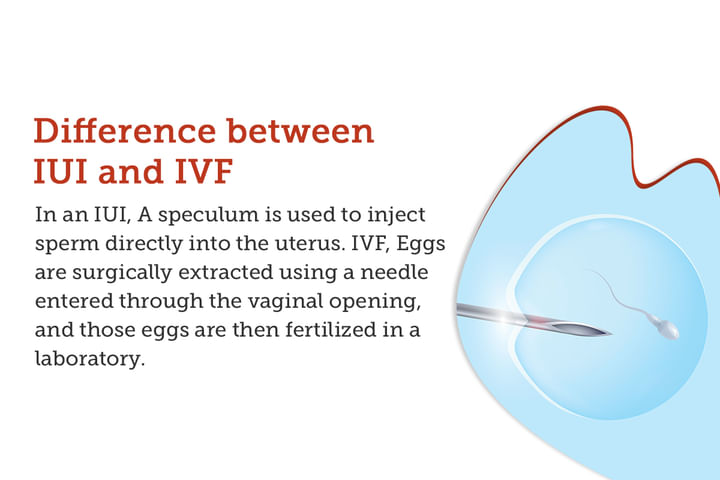 Intrauterine Insemination Iui Treatment Procedure Cost And Success