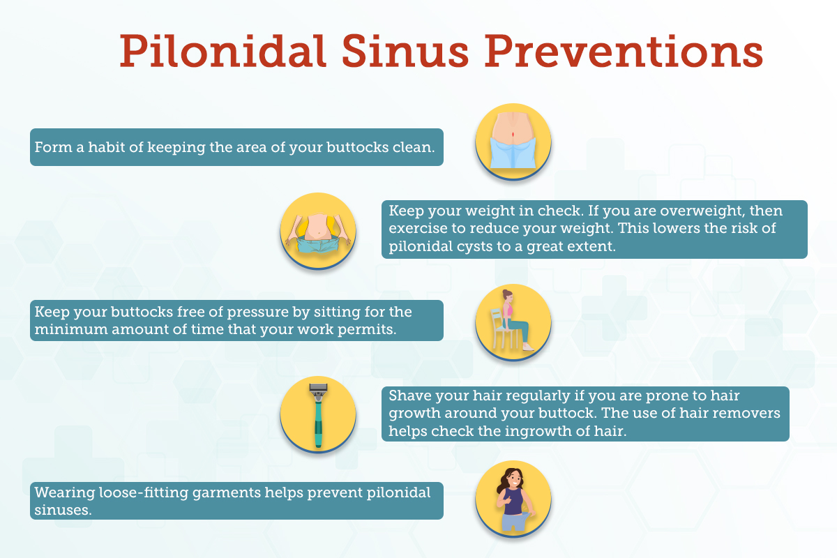 Pilonidal Sinus: Treatment, Procedure, Cost, Recovery, Side Effects And ...