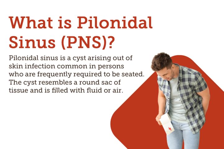 Pilonidal Sinus Treatment Procedure Cost Recovery Side Effects And
