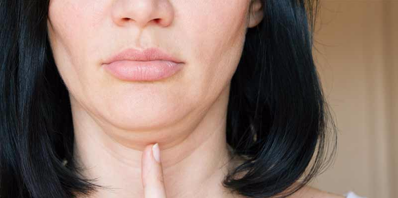 How Can You Get Rid Of Double Chin?