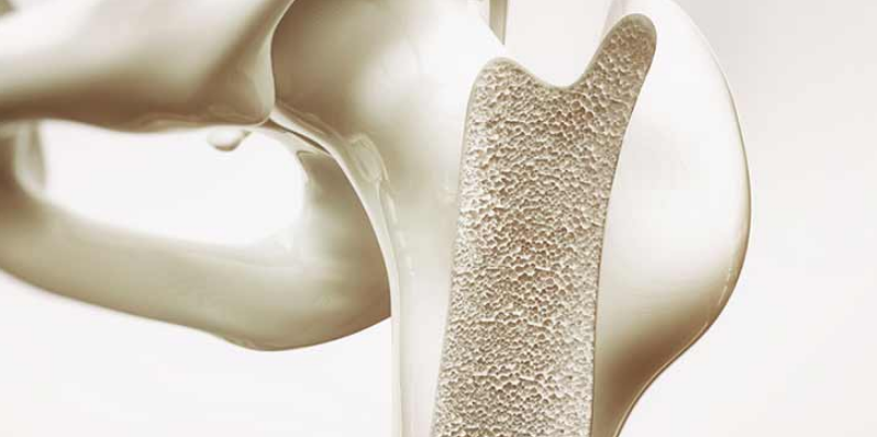 How To Protect And Strengthen Your Bones After 30?