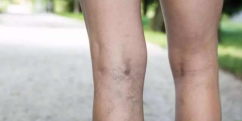 Unequal Leg Length - What Should We Know About It?