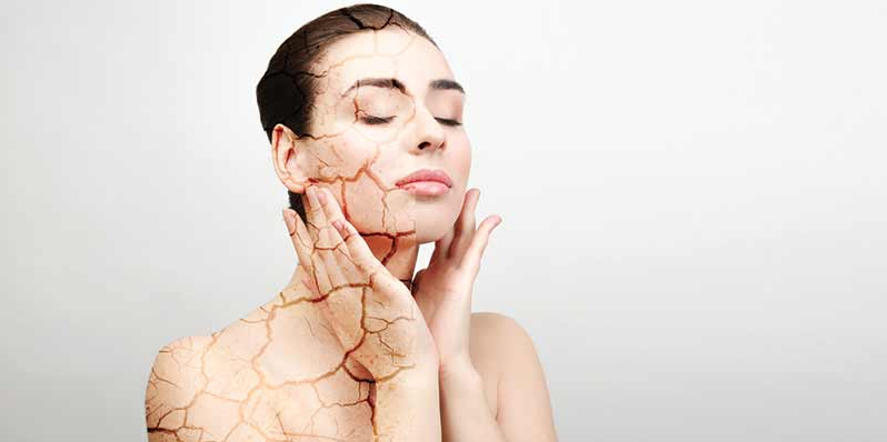 Dry Skin - Causes and Management!