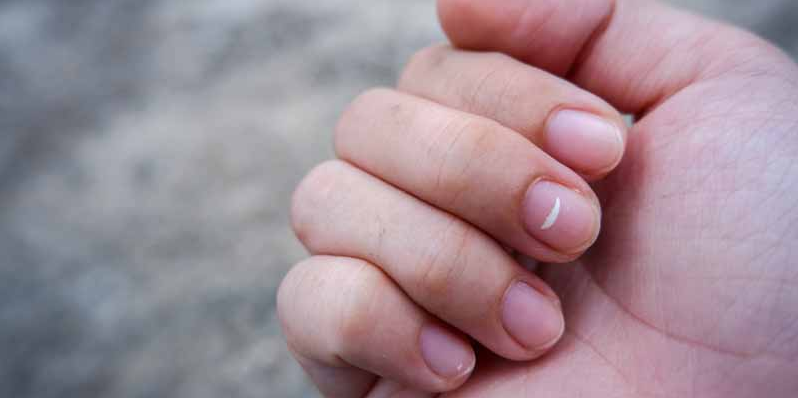 Lack Of Calcium And Its Effect On Your Joints!