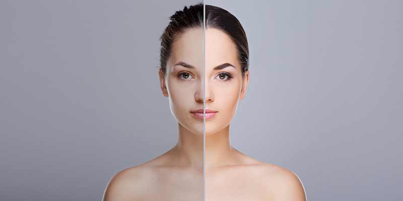 All you need to know about the types of skin pigmentation and its solution