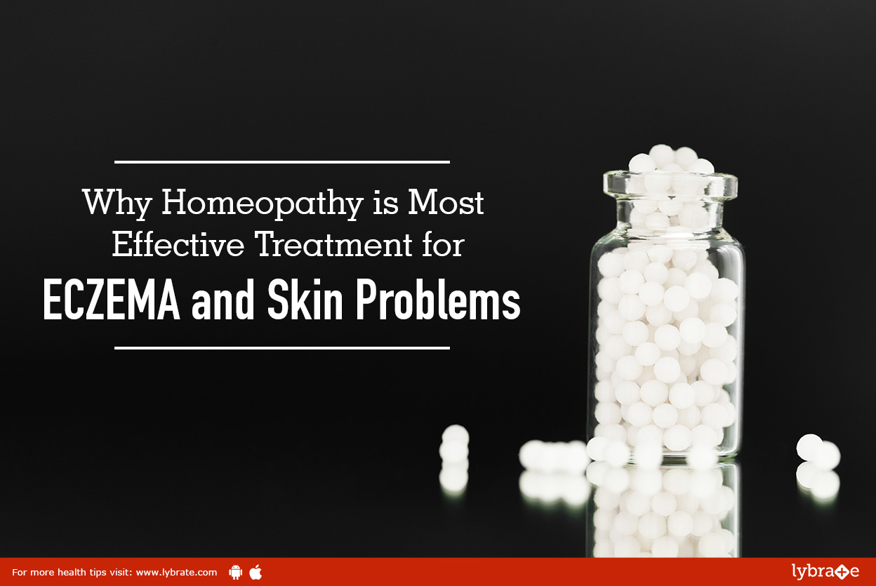 Why Homeopathy is Most Effective Treatment for ECZEMA and Skin Problems ...