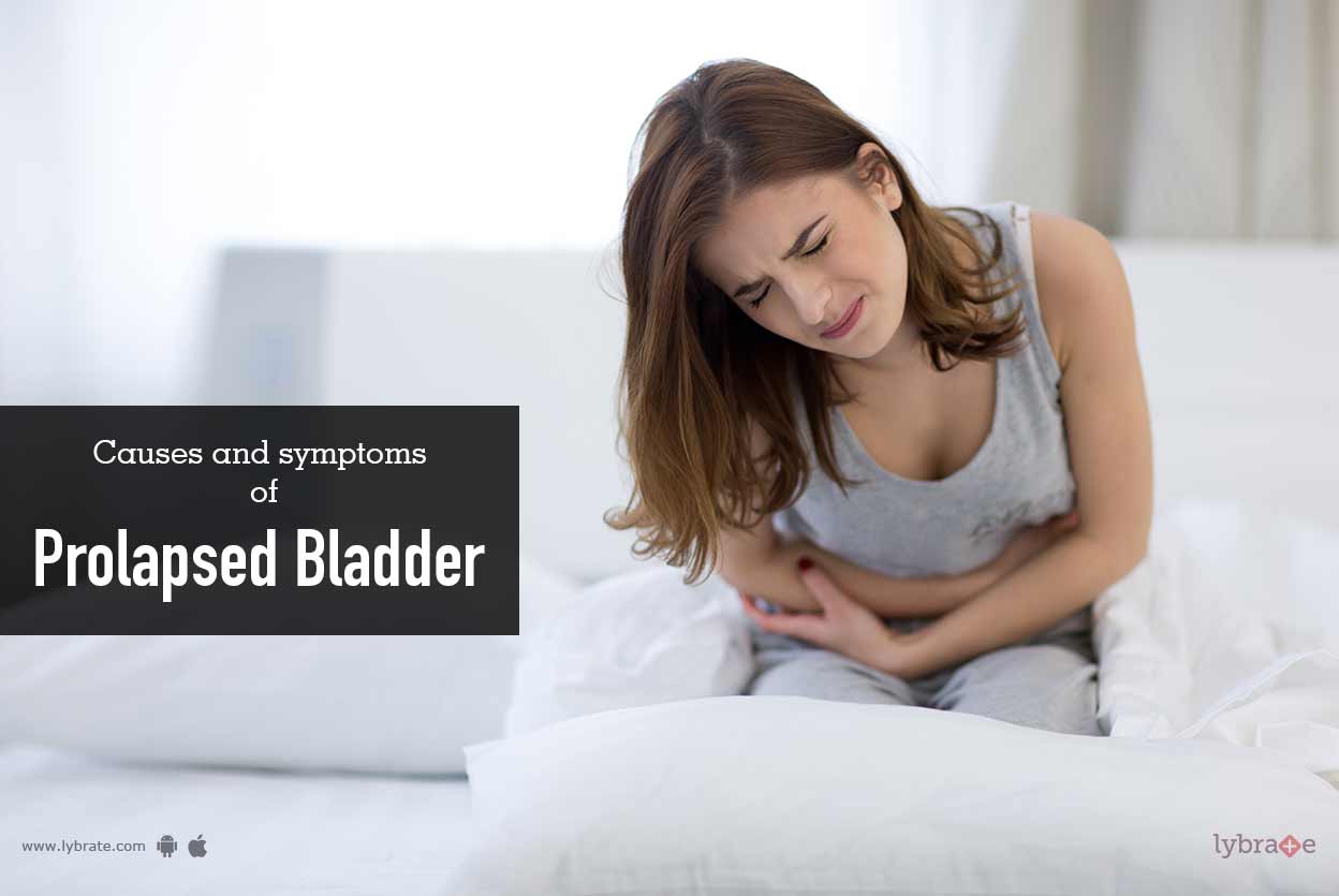 Mild Prolapsed Bladder