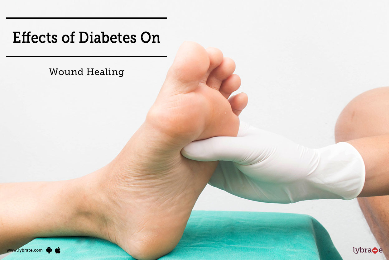 Effects of Diabetes On Wound Healing - By Dr. Garima | Lybrate