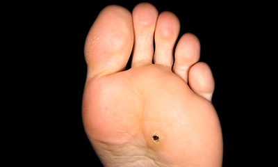 confido: Effects, Uses, Dosage & Information | Lybrate