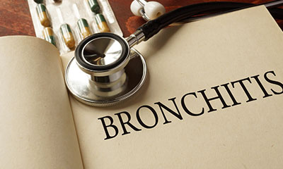 Accentuated bronchovascular markings are noted in bilateral peri-hilar ...