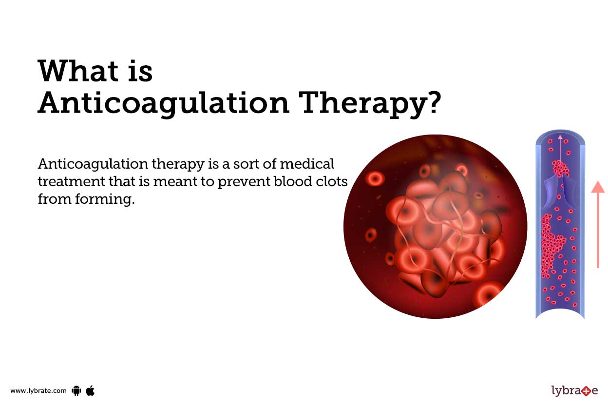 Anticoagulation Causes Symptoms Treatment And Cost Anticoagulation Causes Symptoms Treatment And Cost