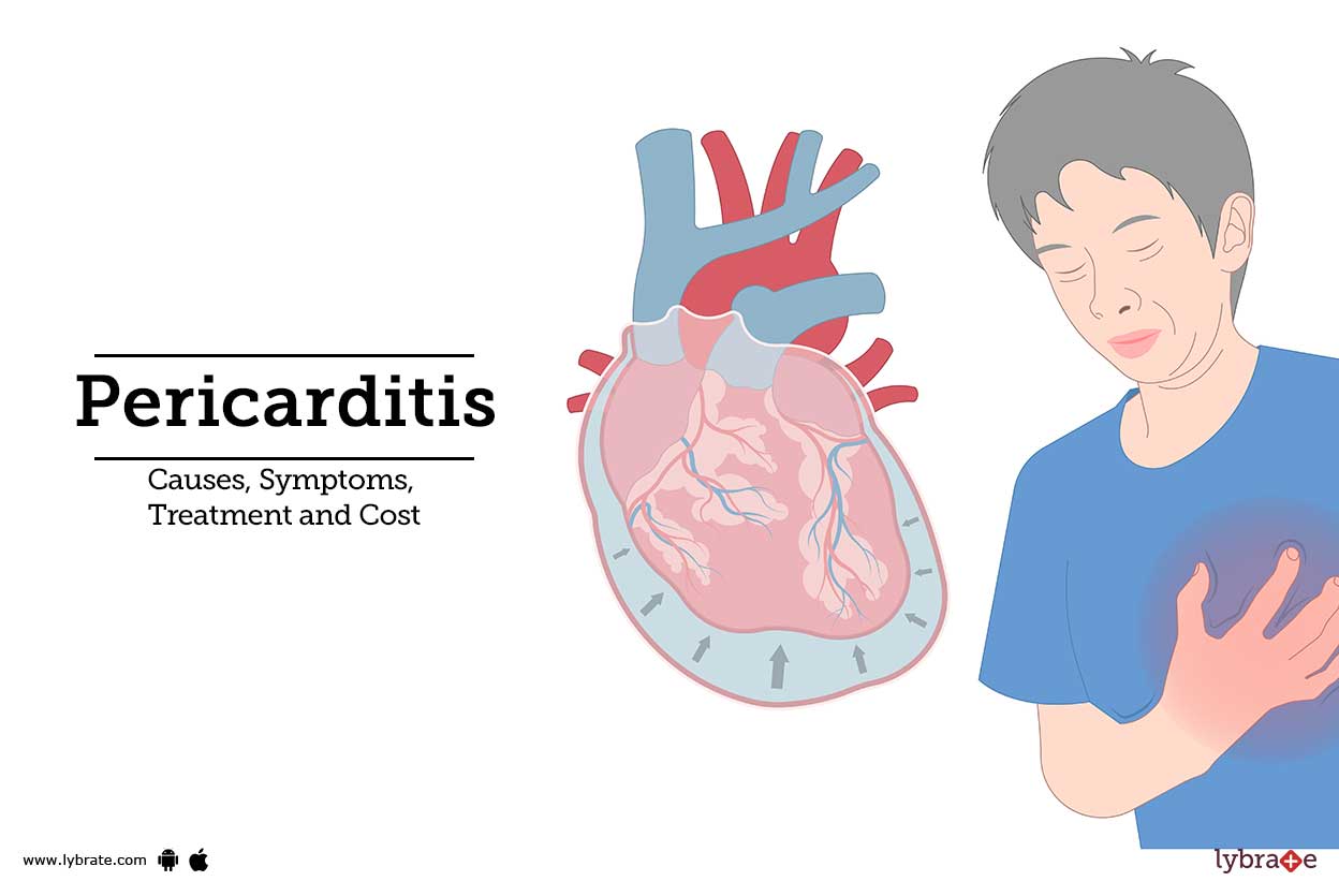 Pericarditis Causes Symptoms Treatment And Cost Pericarditis Causes Symptoms Treatment And Cost