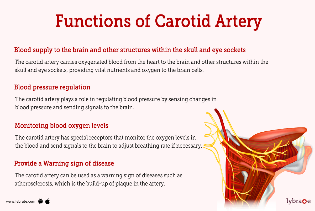 Enlarged Carotid Artery Symptoms Spontaneous Dissection Of The Carotid Enlarged Carotid Artery Symptoms Spontaneous Dissection Of The Carotid