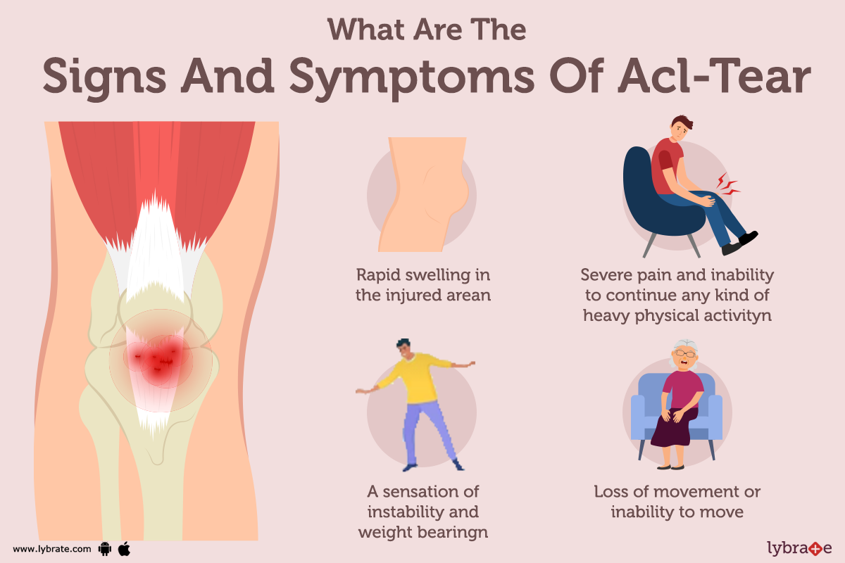 Anterior Cruciate Ligament ACL Tear Symptoms Causes Treatment And Anterior Cruciate Ligament ACL Tear Symptoms Causes Treatment And