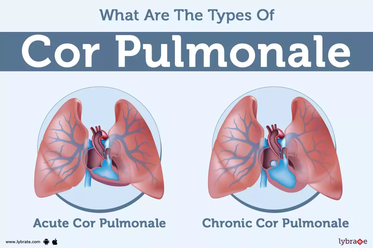 Cor Pulmonale Causes Symptoms Treatment And Cost Cor Pulmonale Causes Symptoms Treatment And Cost