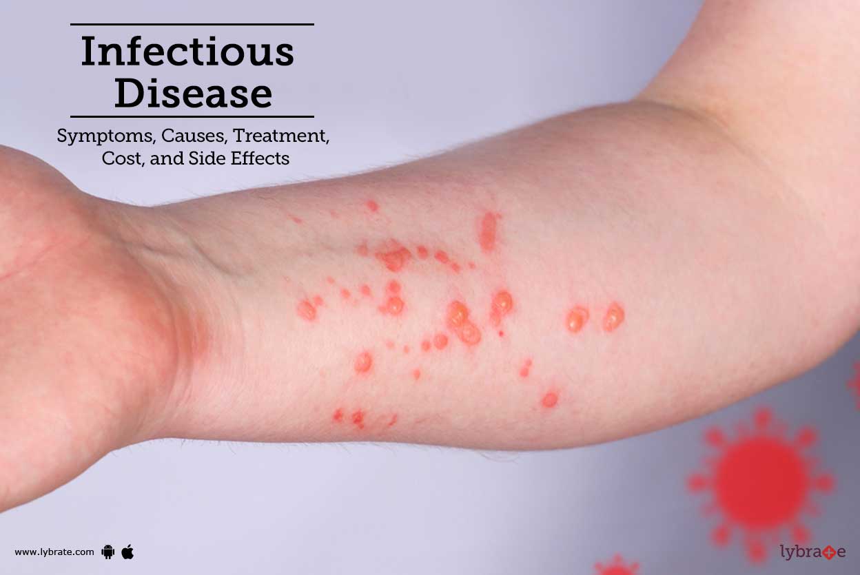 Infectious Disease: Symptoms, Causes, Treatment, Cost, and Side Effects