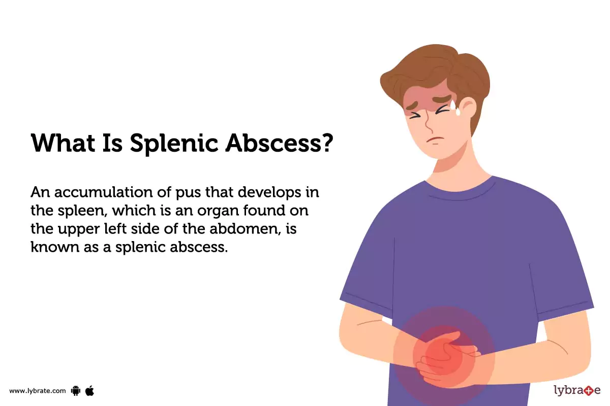 Splenic Abscess Causes Symptoms Treatment And Cost Splenic Abscess Causes Symptoms Treatment And Cost