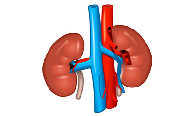 How to remove kidney stone with mid pole calculus measuring 5.9mm and ...