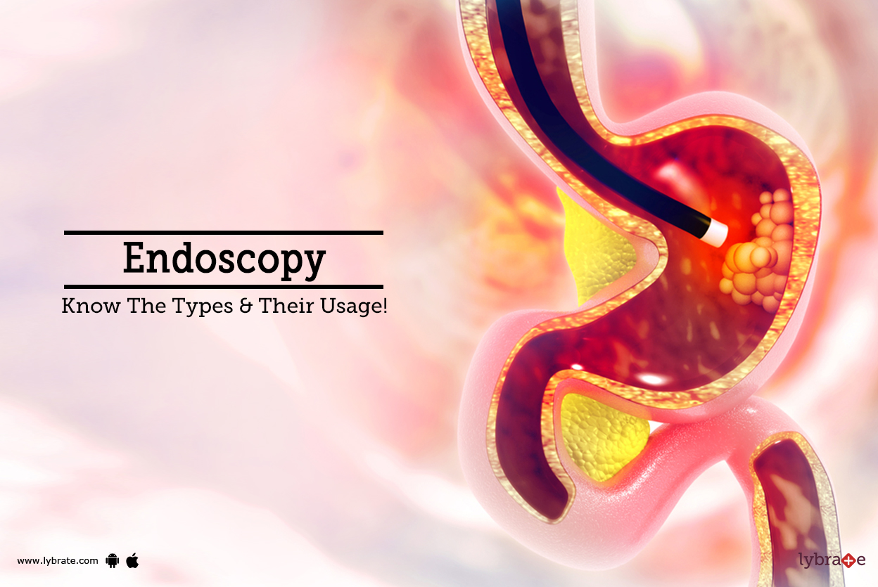 Endoscopy - Know The Types & Their Usage! - By Dr. Lata Prasad | Lybrate