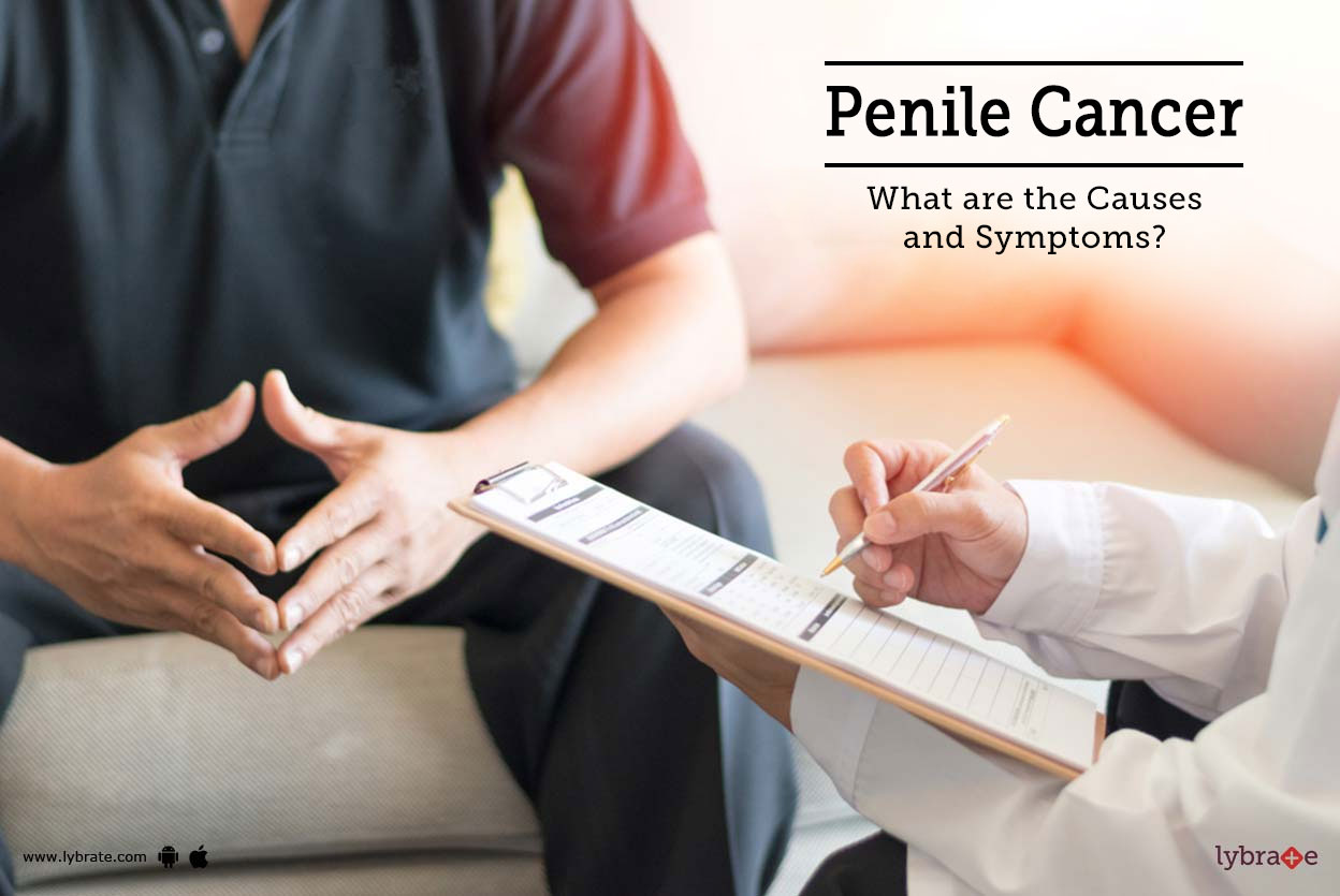 Penile Cancer: What are the Causes and Symptoms? - By Dr. Garima | Lybrate
