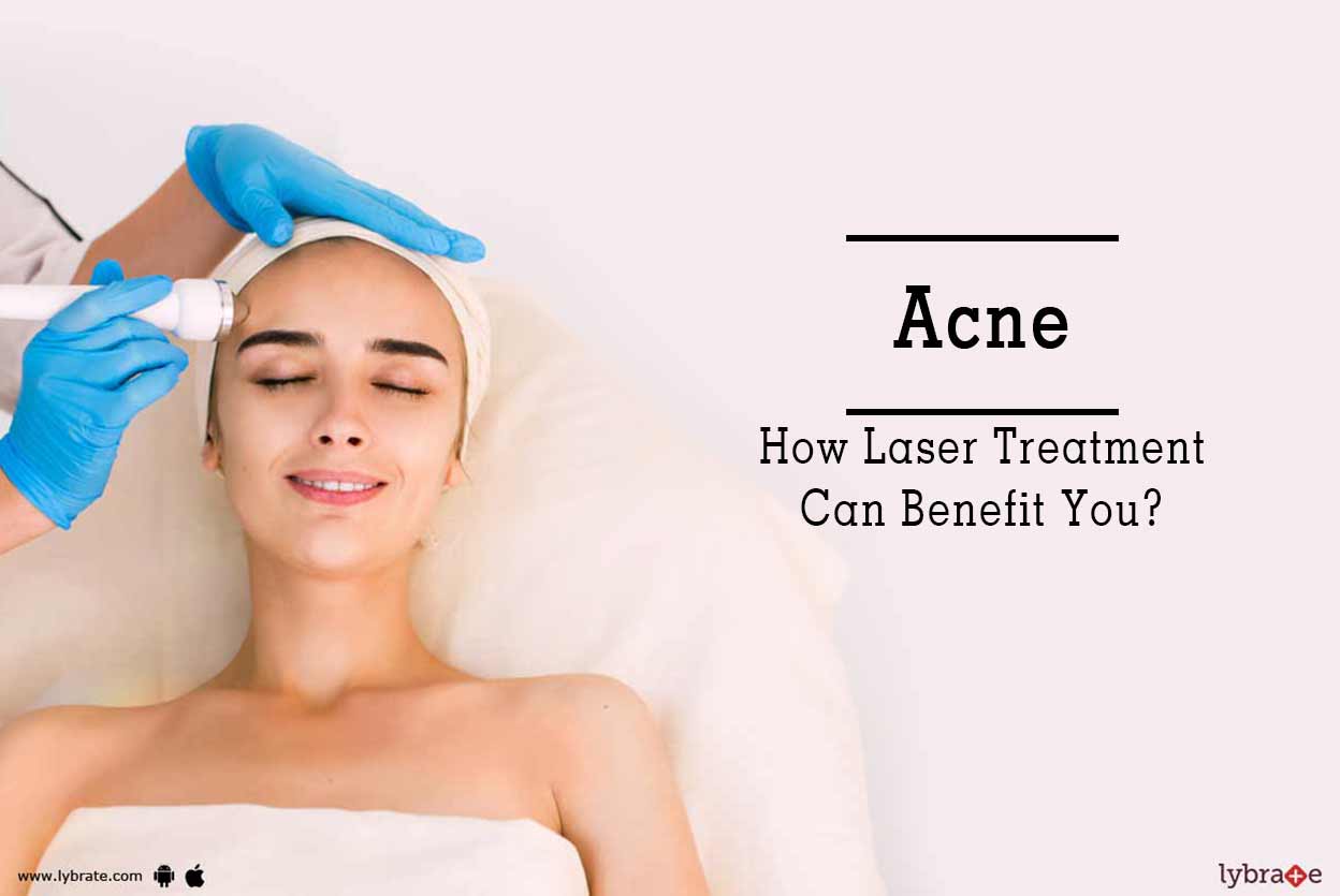 Acne - How Laser Treatment Can Benefit You? - By Dr. Ayesha Khan | Lybrate