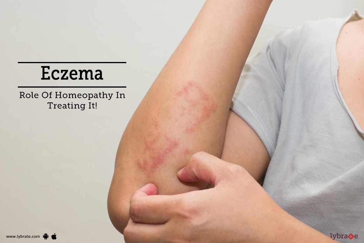 Papular Eczema: Symptoms, Causes, And Treatments, 54% OFF