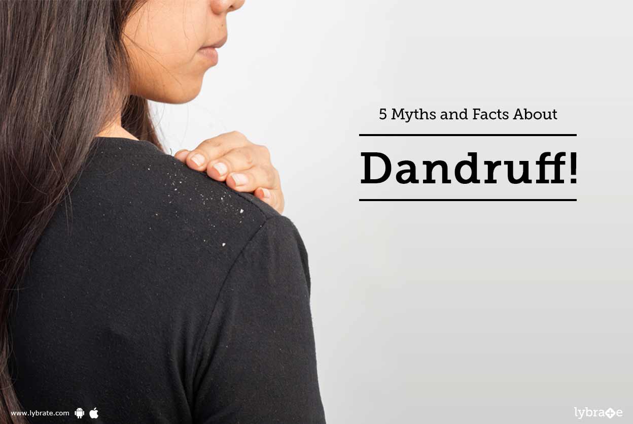 5 Myths and Facts About Dandruff! - By Dr. Richa Thakur | Lybrate
