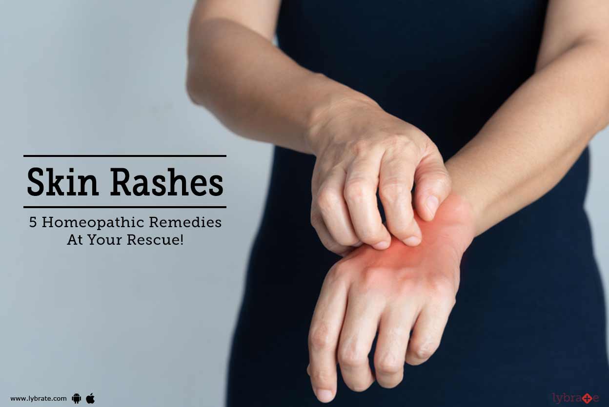 Skin Rashes - 5 Homeopathic Remedies At Your Rescue! - By Dr. Sonali ...