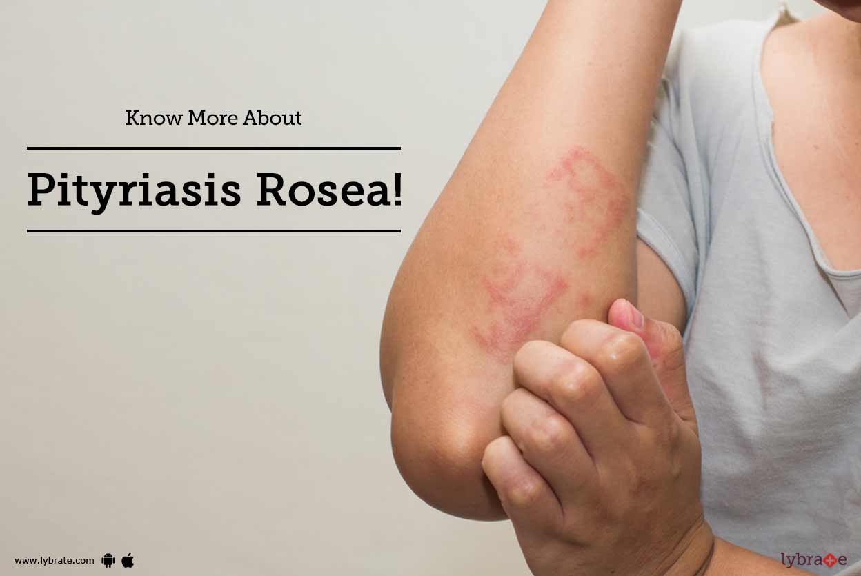 Know More About Pityriasis Rosea! - By Dr. Tanumay Raychaudhury | Lybrate