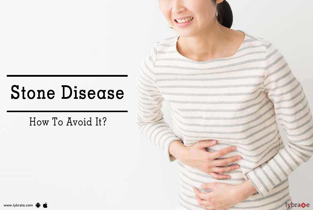 Stone Disease - How To Avoid It? - By Dr. Harbinder Singh | Lybrate