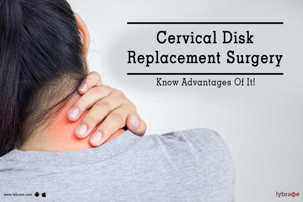 Cervical Disk Replacement Surgery - Know Advantages Of It! - By Dr ...