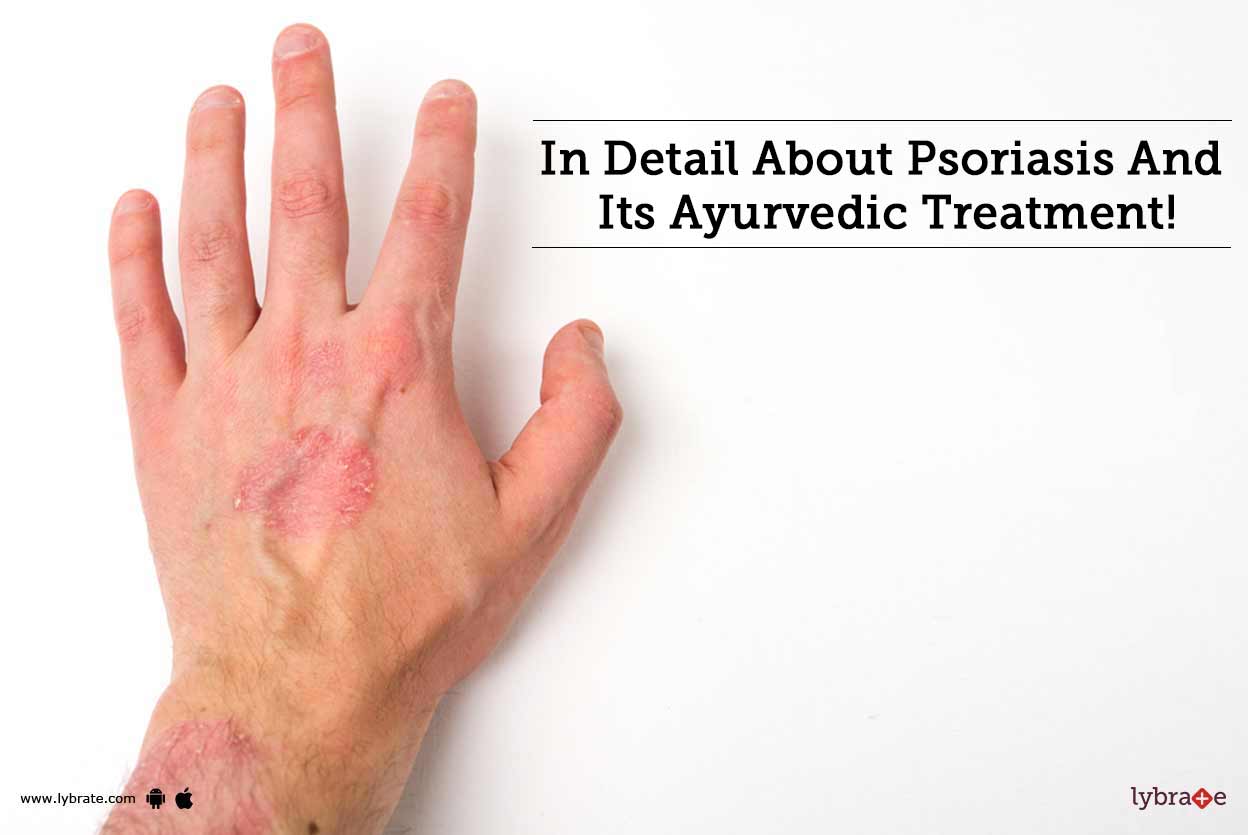 In Detail About Psoriasis And Its Ayurvedic Treatment! - By Dr. Muneeb ...