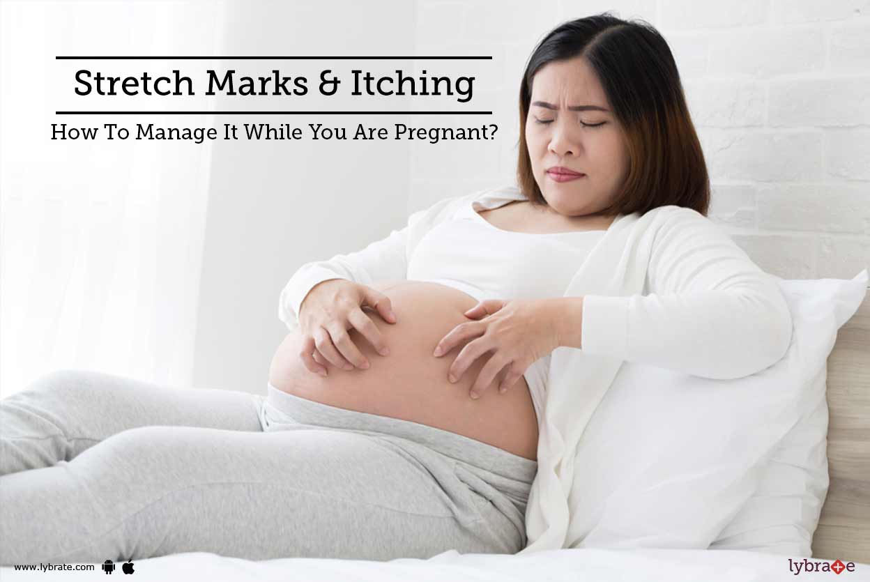 Stretch Marks & Itching - How To Manage It While You Are Pregnant? - By ...