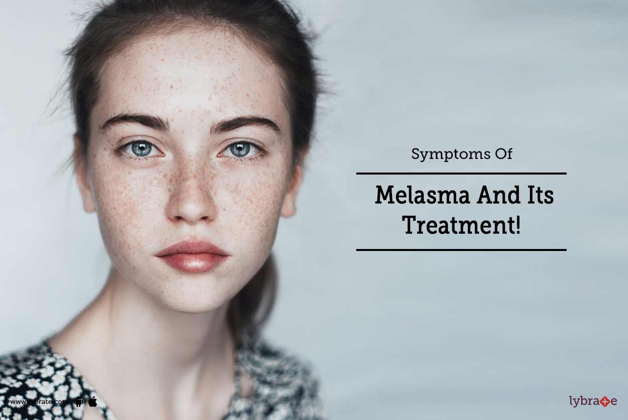 Symptoms Of Melasma And Its Treatment! - By Dr. Priyali Shah | Lybrate