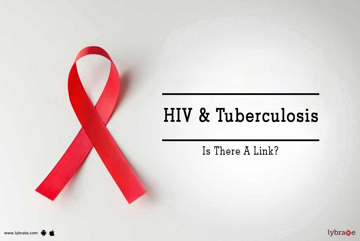 HIV & Tuberculosis - Is There A Link? - By Dr. Lt Col Adnan Masood ...