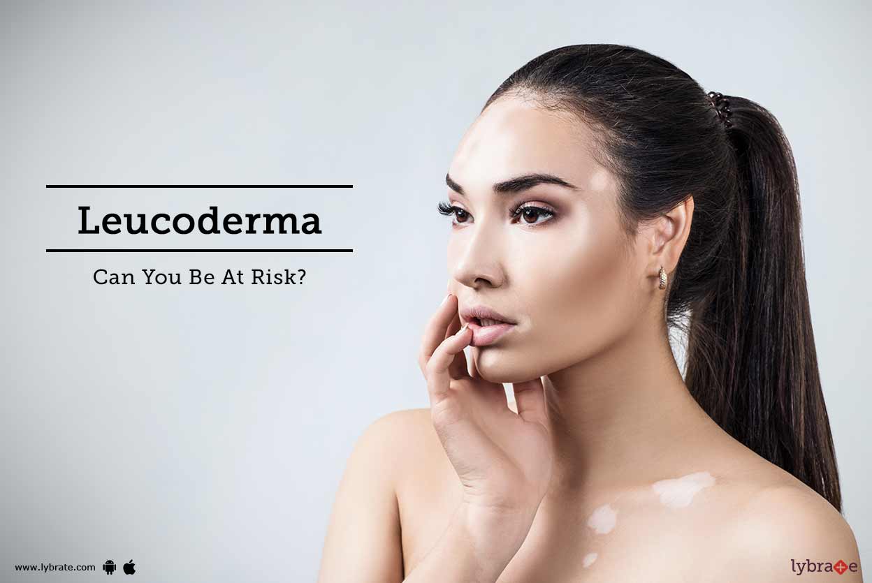 Leucoderma - Can You Be At Risk? - By Dr. Nitin Jain | Lybrate